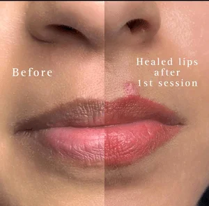 Get Perfect Lip Correction In Thane | Victress Beauty Lounge