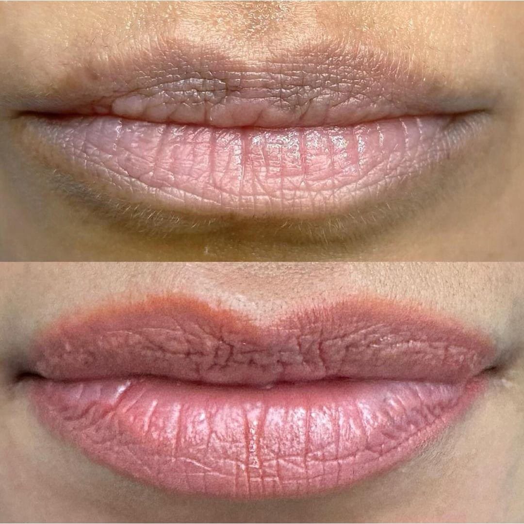 Transform Your Look with Lip Color Correction Services | Victress ...